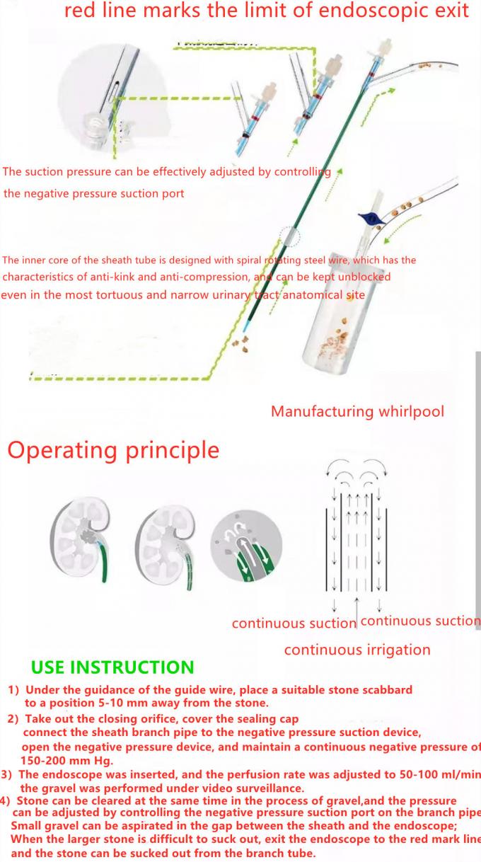Silicon Ureteral Access Sheath , Clear Petra Ureteral Access Sheath