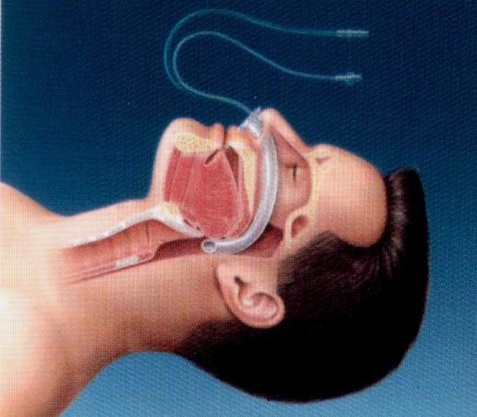 Hospital PVC NPA Nasal Airway , Soft NPA Nasopharyngeal Airway